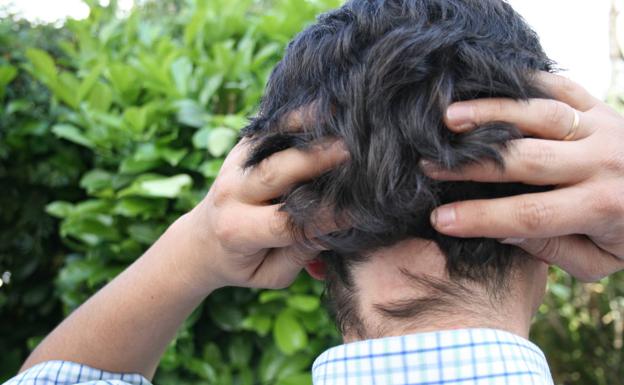 Casos De Tiña En Peluquerías Así Es La Tiña Síntomas Cómo Se